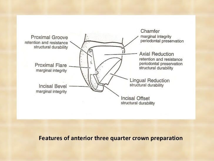 tooth preparation-partial veneers