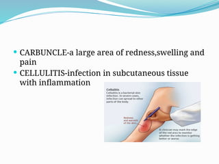 STAPHYLOCOCCUS,Introduction, history, morphology | PPT