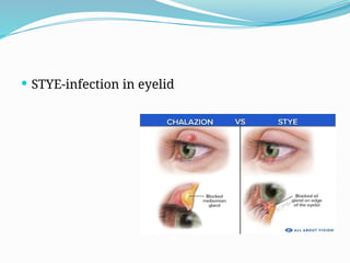STAPHYLOCOCCUS,Introduction, history, morphology | PPT