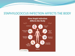 STAPHYLOCOCCUS,Introduction, history, morphology | PPT