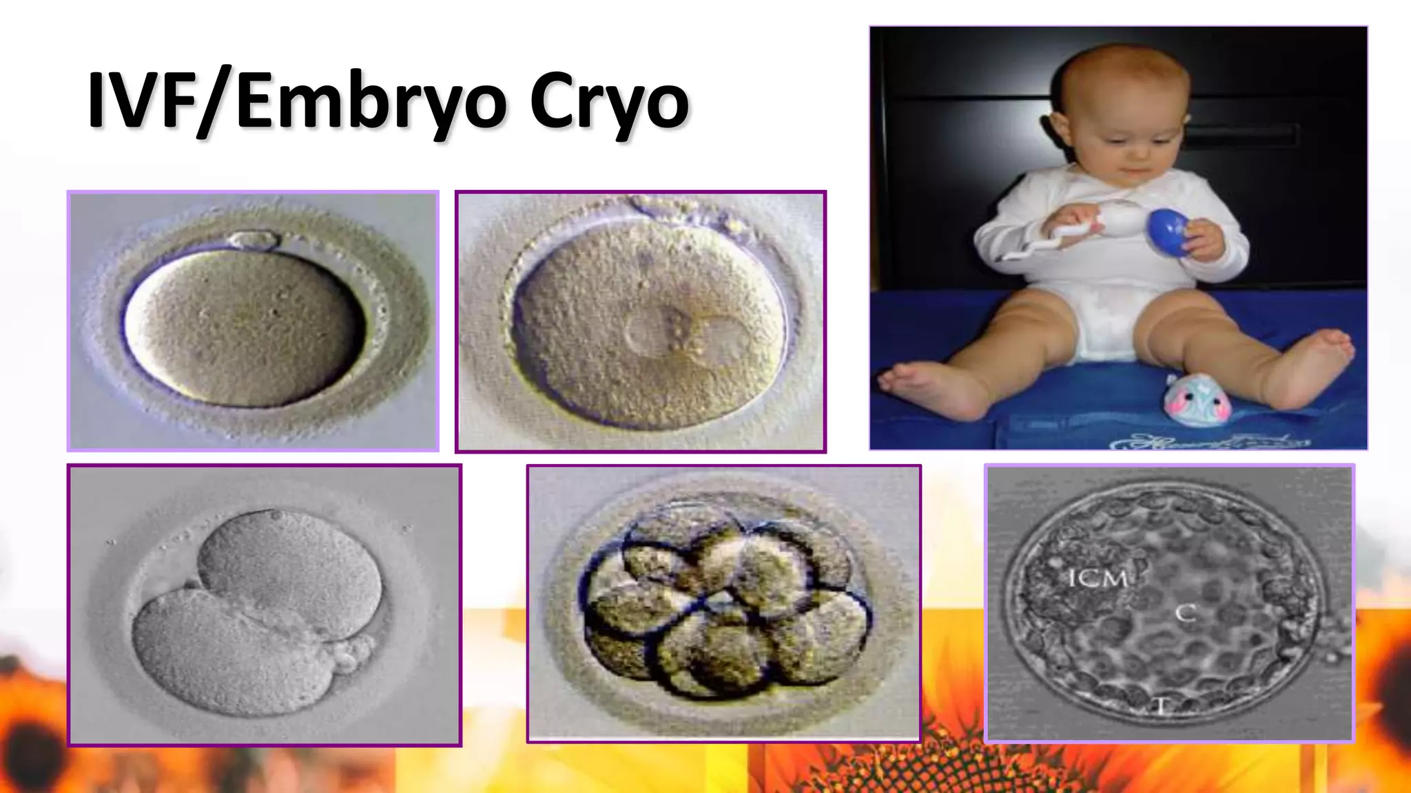 FERTILITY PRESERVATION TECHNIQUES | PPTX