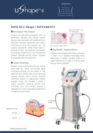 Ushape II | PDF