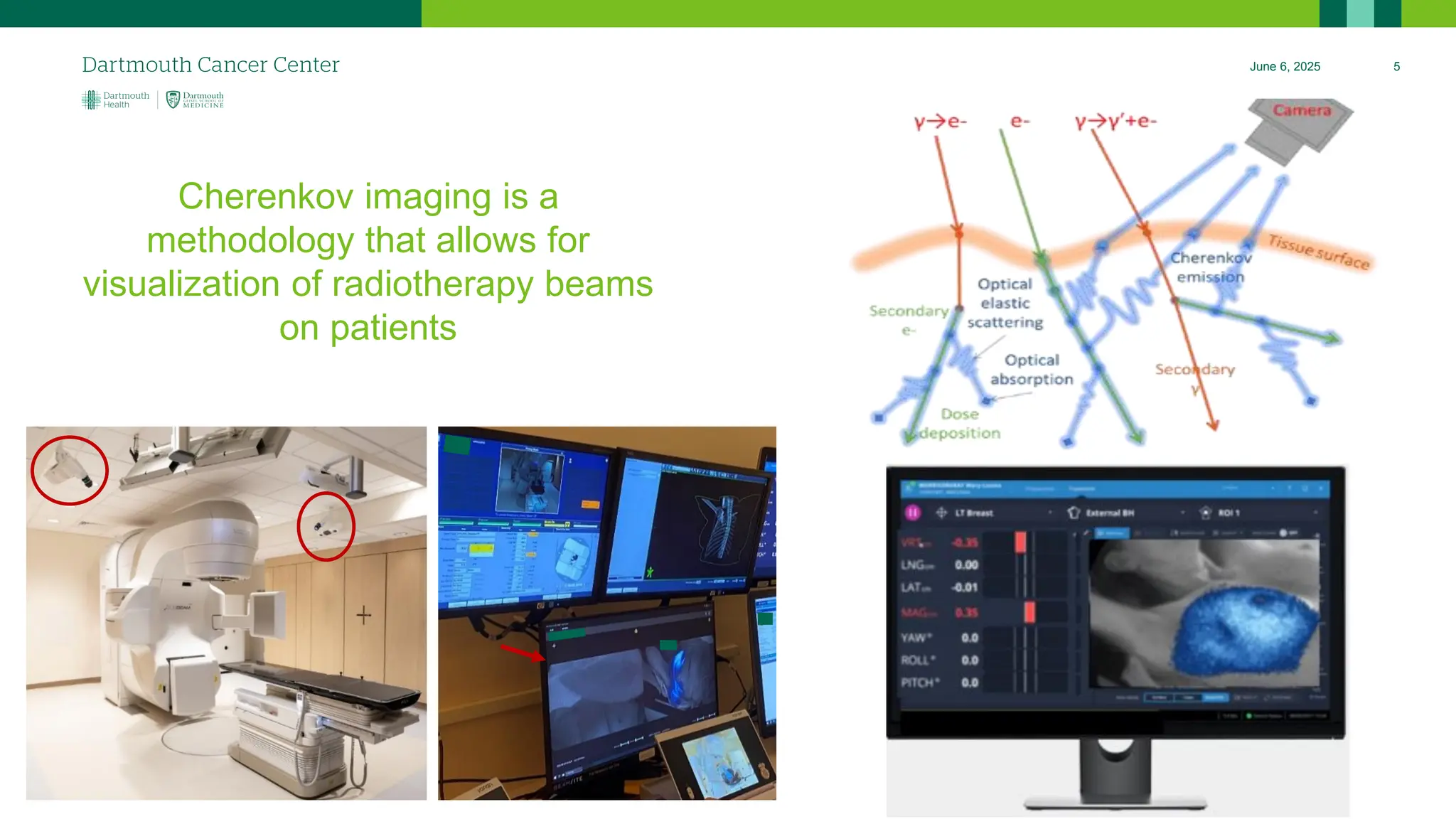 Using Cherenkov Imaging and Scintillation Dosimetry to Quantify Contralateral Breast Dose in ...
