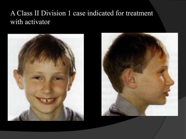 Using activator as first phase of treatment | PPT