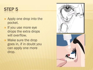 Using eye drops | PDF