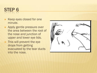 Using eye drops | PDF