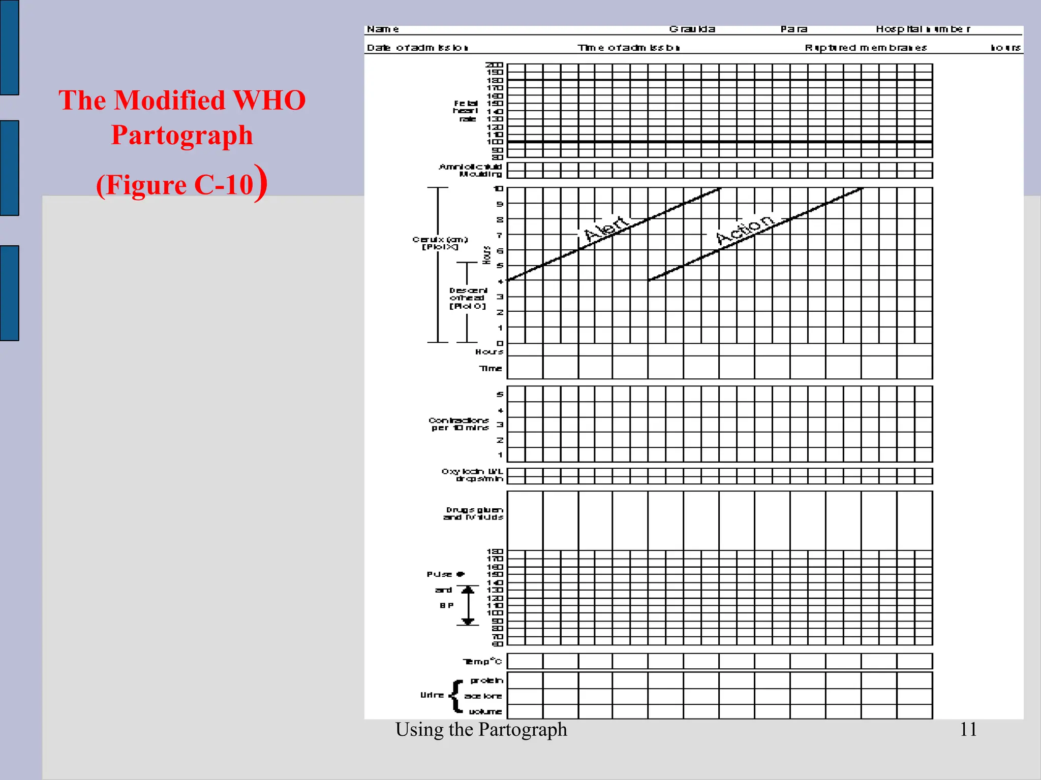 USING PARTOGRAPH.ppt student 2023 slidevvvvvvvvvvvccc | PPT | Pregnancy ...