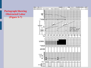 USING PARTOGRAPH.ppt student 2023 slidevvvvvvvvvvvccc | PPT | Pregnancy ...