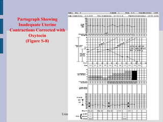 USING PARTOGRAPH.ppt student 2023 slidevvvvvvvvvvvccc | PPT | Pregnancy ...