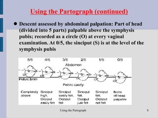 USING PARTOGRAPH.ppt student 2023 slidevvvvvvvvvvvccc | PPT | Pregnancy ...