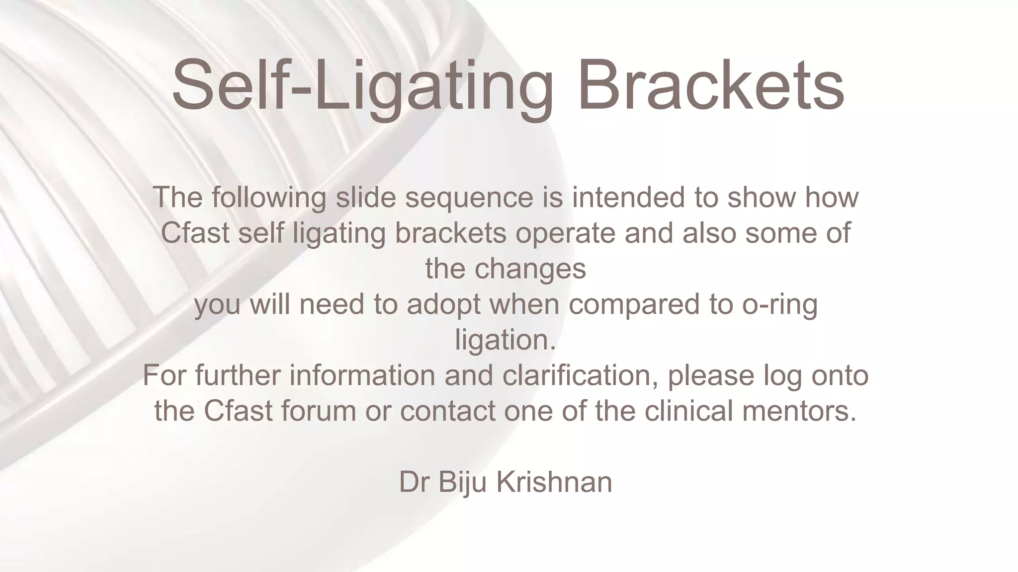 Using self ligating brackets | PPSX