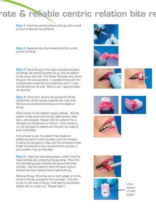 Using the lucia jig for accurate bite s220 | PDF