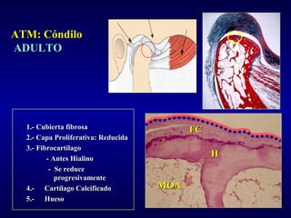 ARTICULACION TEMPOROMANDIBULAR | PPT