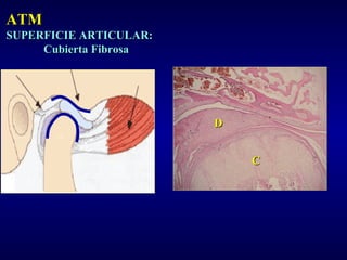 ARTICULACION TEMPOROMANDIBULAR | PPT