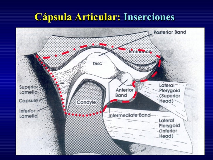 ARTICULACION TEMPOROMANDIBULAR