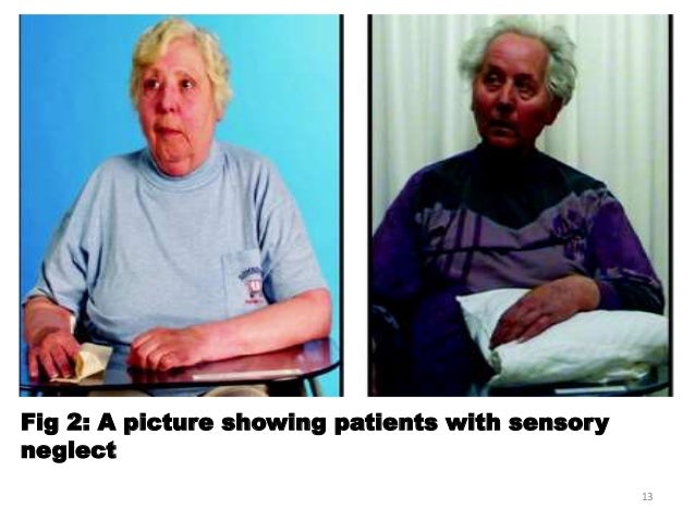 Unilateral spatial neglect ppt