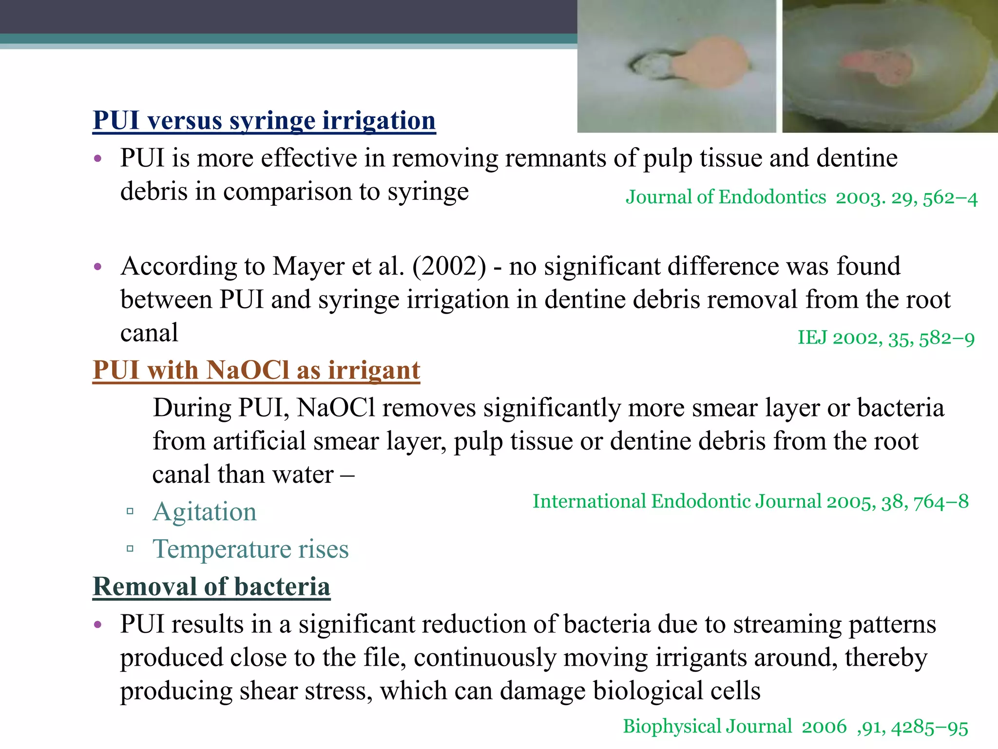 US , magnification, illumination in endo.pptx