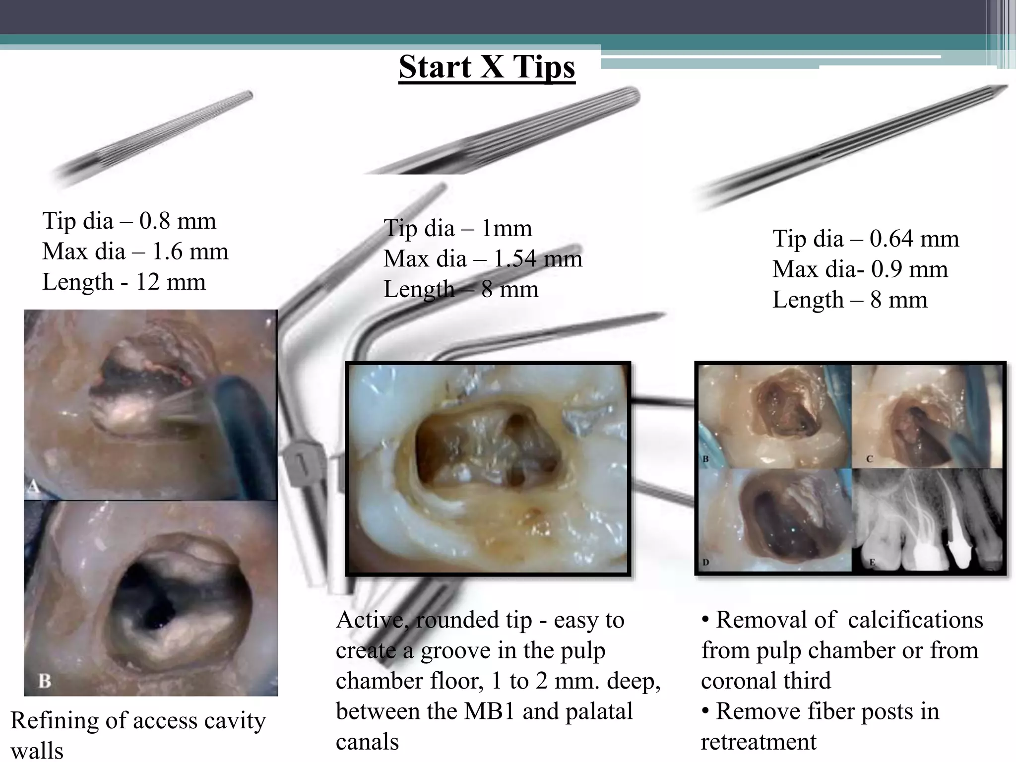 US , magnification, illumination in endo.pptx