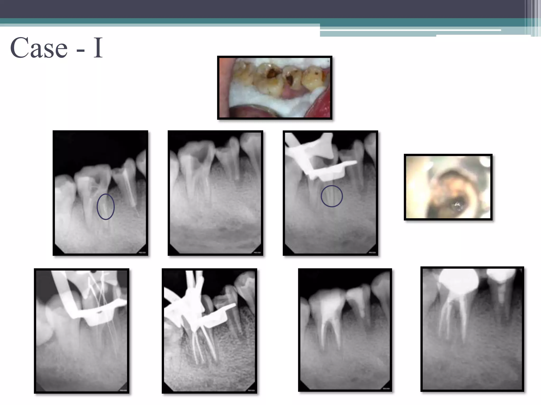 US , magnification, illumination in endo.pptx