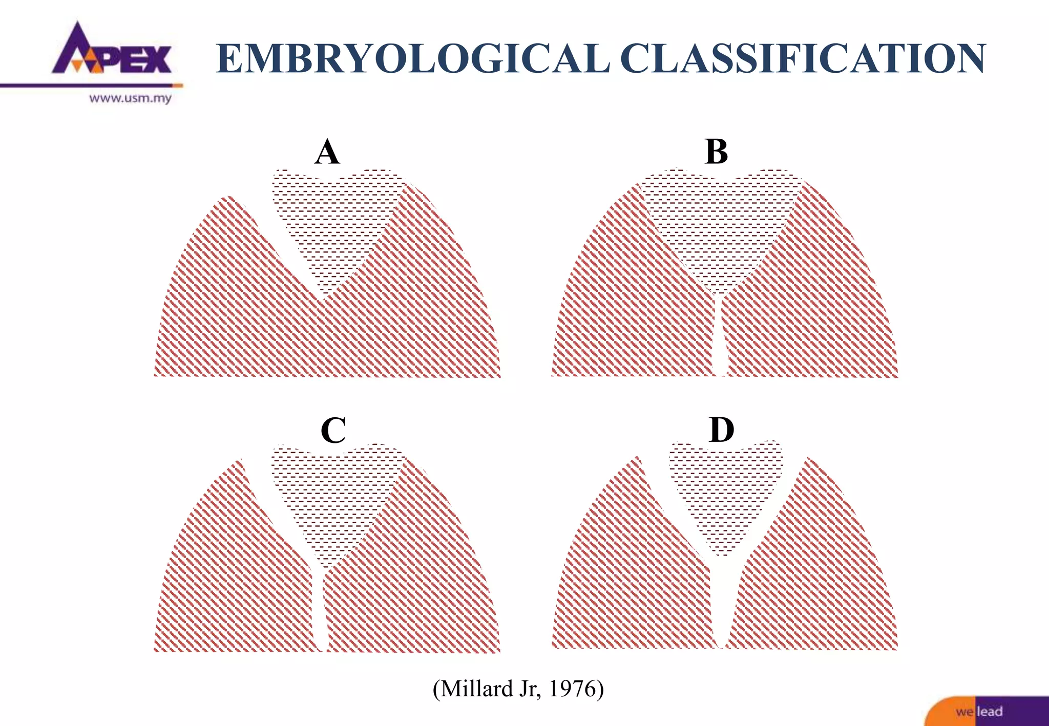 Unilateral Cleft Lip and Palate Treatment Outcome Assessment | PPTX