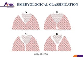 Unilateral Cleft Lip and Palate Treatment Outcome Assessment | PPT