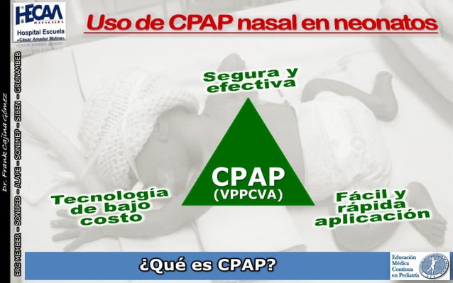 Uso de cpapn en neonatos | PDF