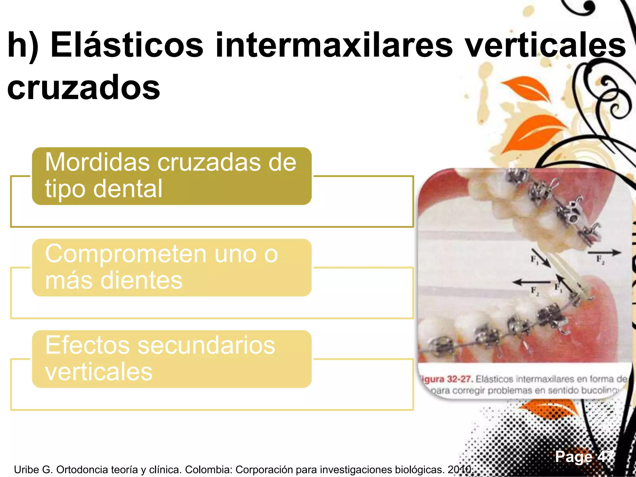 Uso de elásticos y elastómeros en Ortodoncia | PPTX