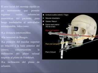 USO DEL ARCO FACIAL | PPT