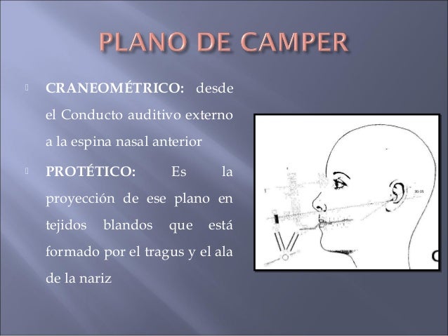 USO DEL ARCO FACIAL