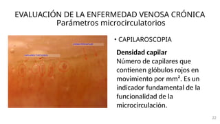 Uso de parámetros microcirculatorios por capilaroscopía para la ...