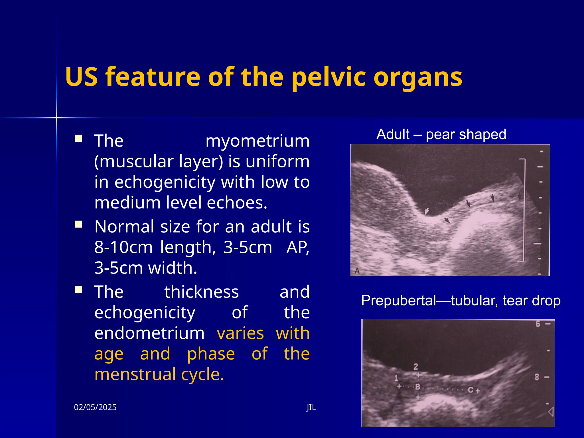US of Female pelvic organs for midwife.pptx