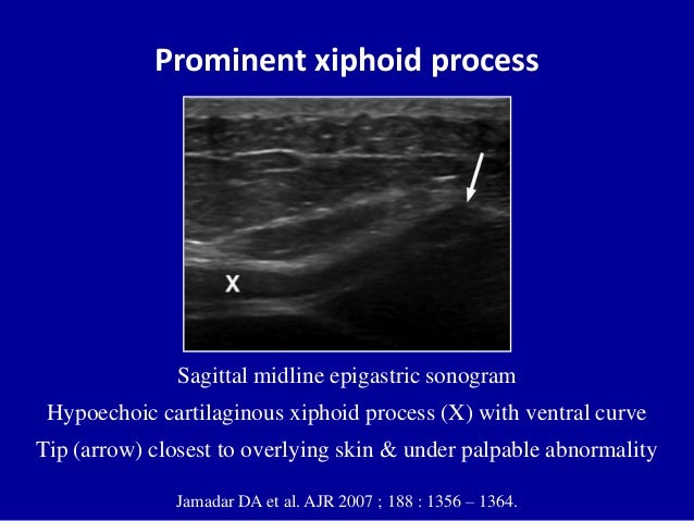 Ultrasound of the abdominal wall hernias