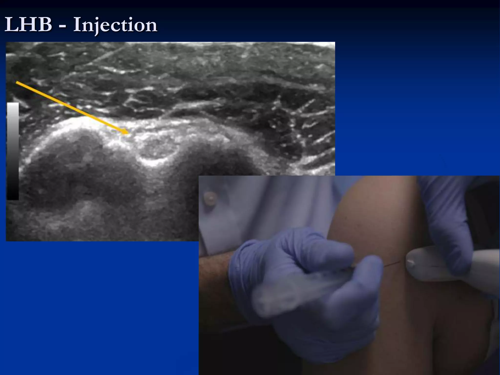 Post-graduate Certifcate Musculoskeletal Ultrasound - The Shoulder ...
