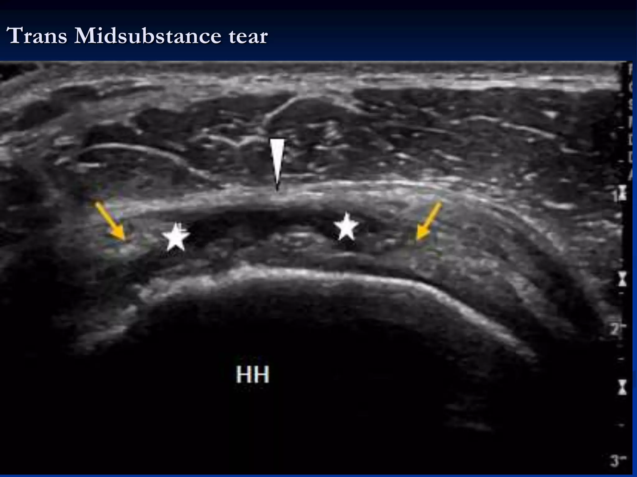 Post-graduate Certifcate Musculoskeletal Ultrasound - The Shoulder ...