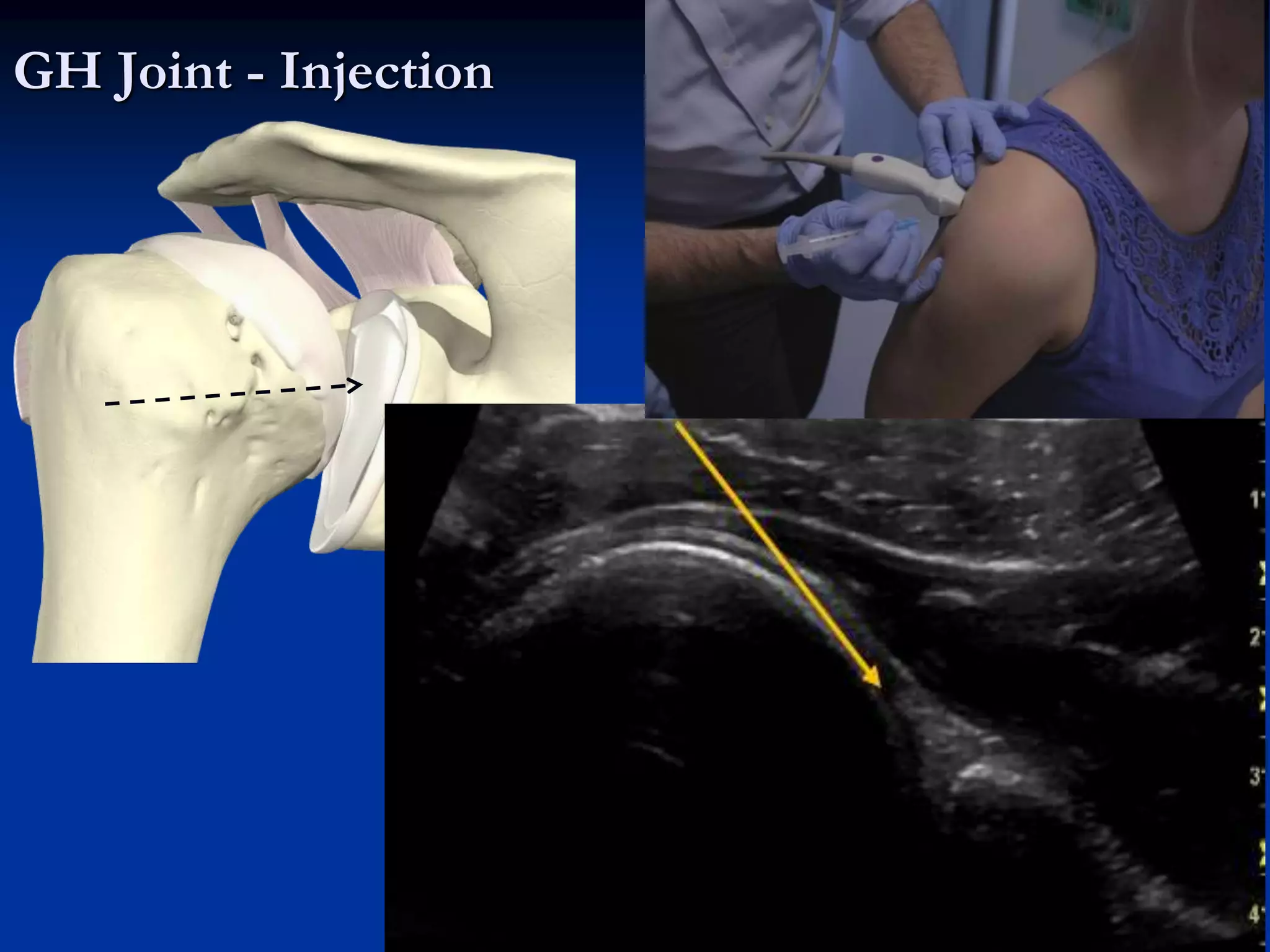 Post-graduate Certifcate Musculoskeletal Ultrasound - The Shoulder ...
