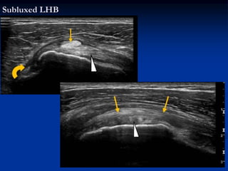 Post-graduate Certifcate Musculoskeletal Ultrasound - The Shoulder ...
