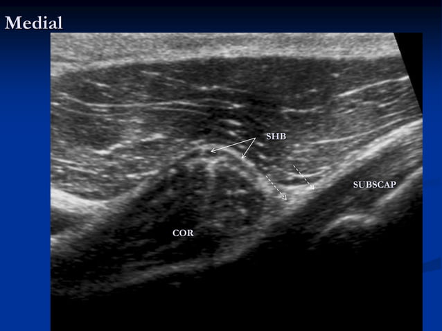 Post-graduate Certifcate Musculoskeletal Ultrasound - The Shoulder | PPT