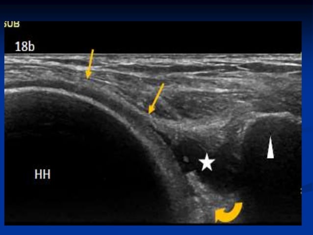 Post-graduate Certifcate Musculoskeletal Ultrasound - The Shoulder | PPT