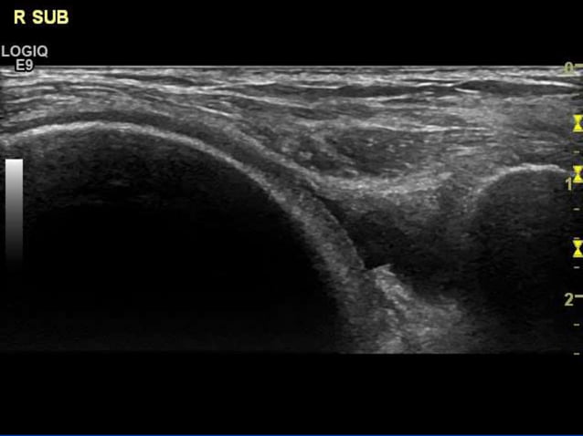 Post-graduate Certifcate Musculoskeletal Ultrasound - The Shoulder | PPT