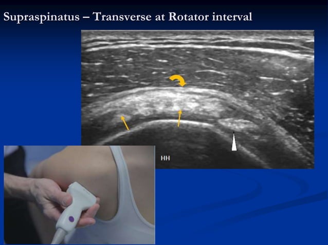 Post-graduate Certifcate Musculoskeletal Ultrasound - The Shoulder | PPT