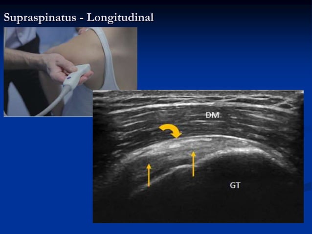 Post-graduate Certifcate Musculoskeletal Ultrasound - The Shoulder | PPT