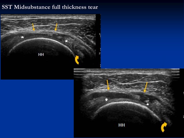 Post-graduate Certifcate Musculoskeletal Ultrasound - The Shoulder | PPT