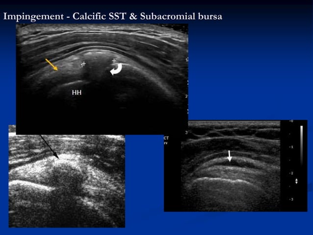 Post-graduate Certifcate Musculoskeletal Ultrasound - The Shoulder | PPT