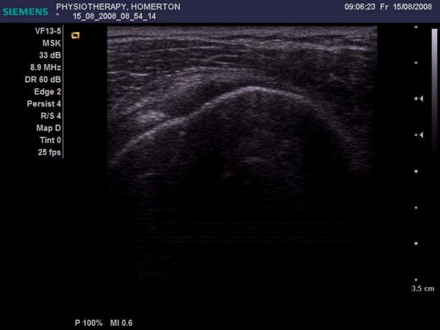 Post-graduate Certifcate Musculoskeletal Ultrasound - The Shoulder | PPT