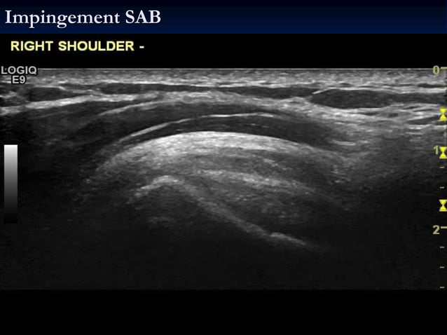 Post-graduate Certifcate Musculoskeletal Ultrasound - The Shoulder | PPT