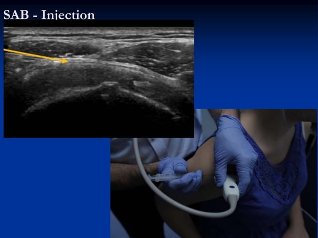 Post-graduate Certifcate Musculoskeletal Ultrasound - The Shoulder | PPT