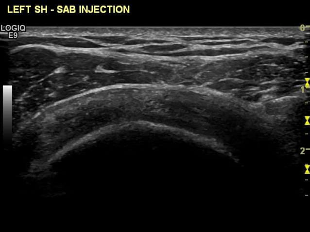 Post-graduate Certifcate Musculoskeletal Ultrasound - The Shoulder | PPT