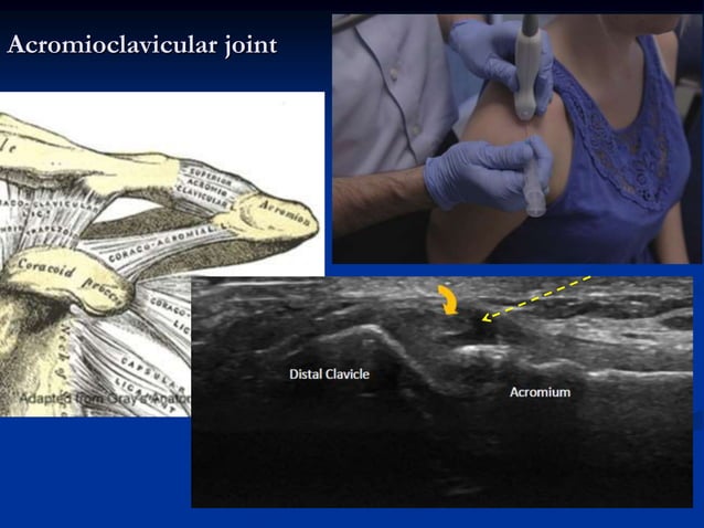 Post-graduate Certifcate Musculoskeletal Ultrasound - The Shoulder | PPT