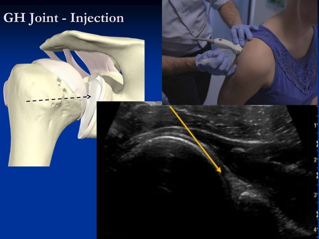 Post-graduate Certifcate Musculoskeletal Ultrasound - The Shoulder | PPT