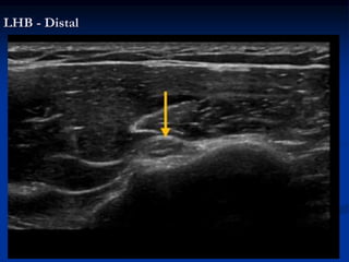 Post-graduate Certifcate Musculoskeletal Ultrasound - The Shoulder ...
